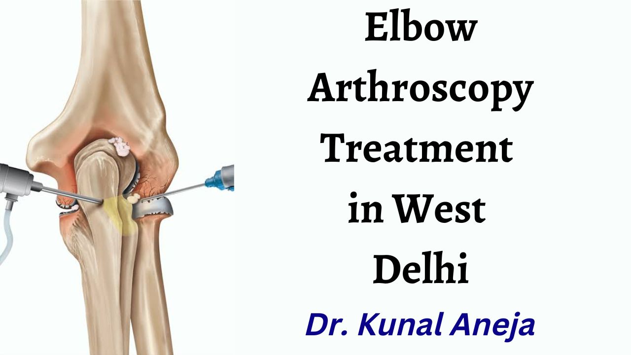 Elbow Arthroscopy Treatment in West Delhi-Dr. Kunal Aneja
