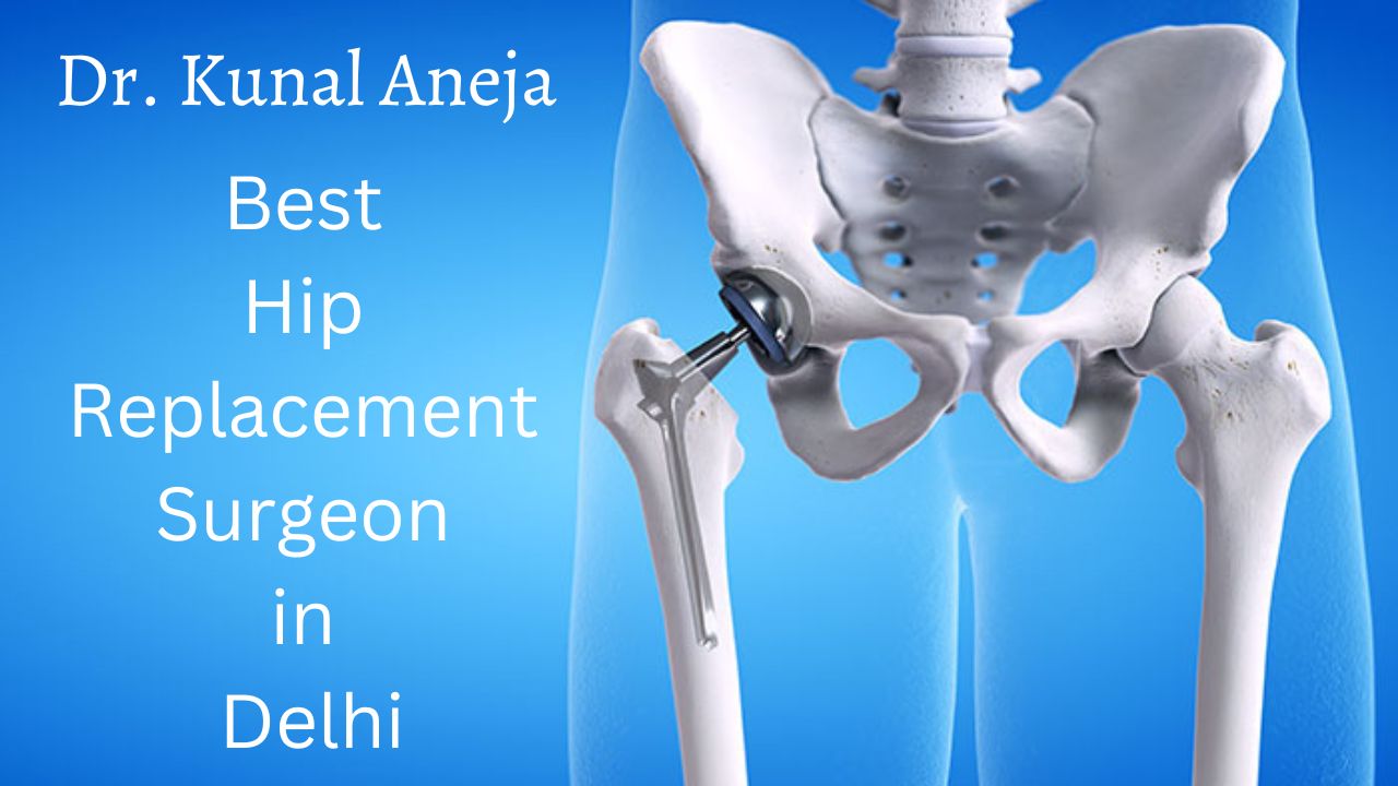 Best Hip Replacement Surgeon in Delhi- Dr. Kunal Aneja