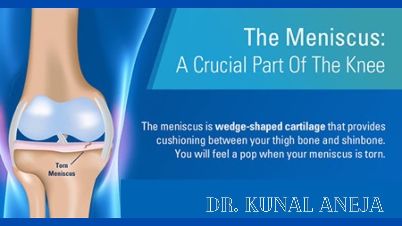 Meniscus Treatment - Dr. Kunal Aneja