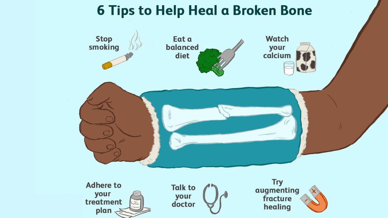 Bone Fracture Treatment - Dr. Kunal Aneja