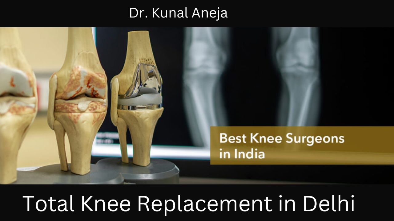 Expert Total Knee Replacement in Delhi-Dr. Kunal Aneja