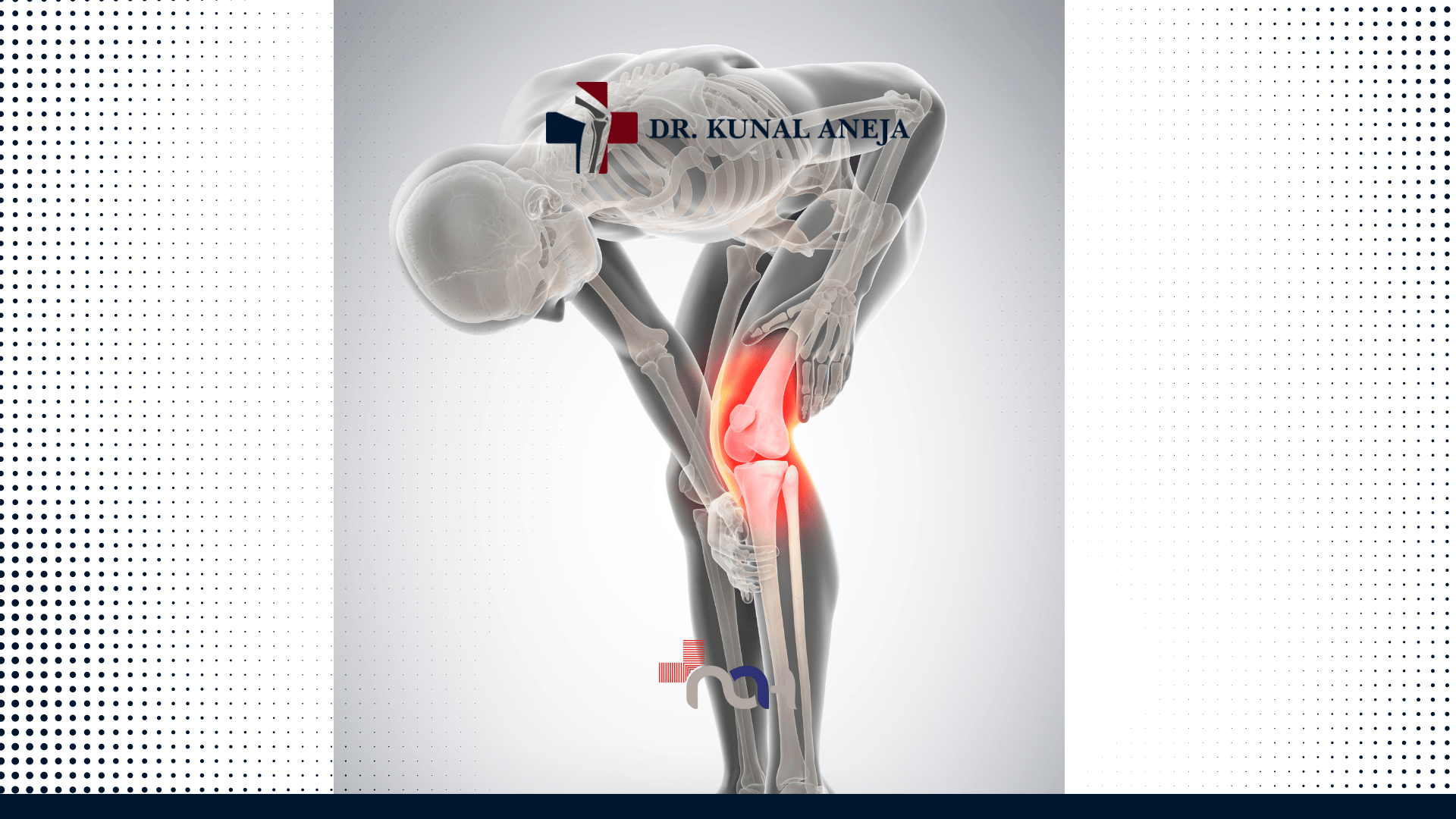 #1 Robotic Knee Replacement Surgeon in Delhi
