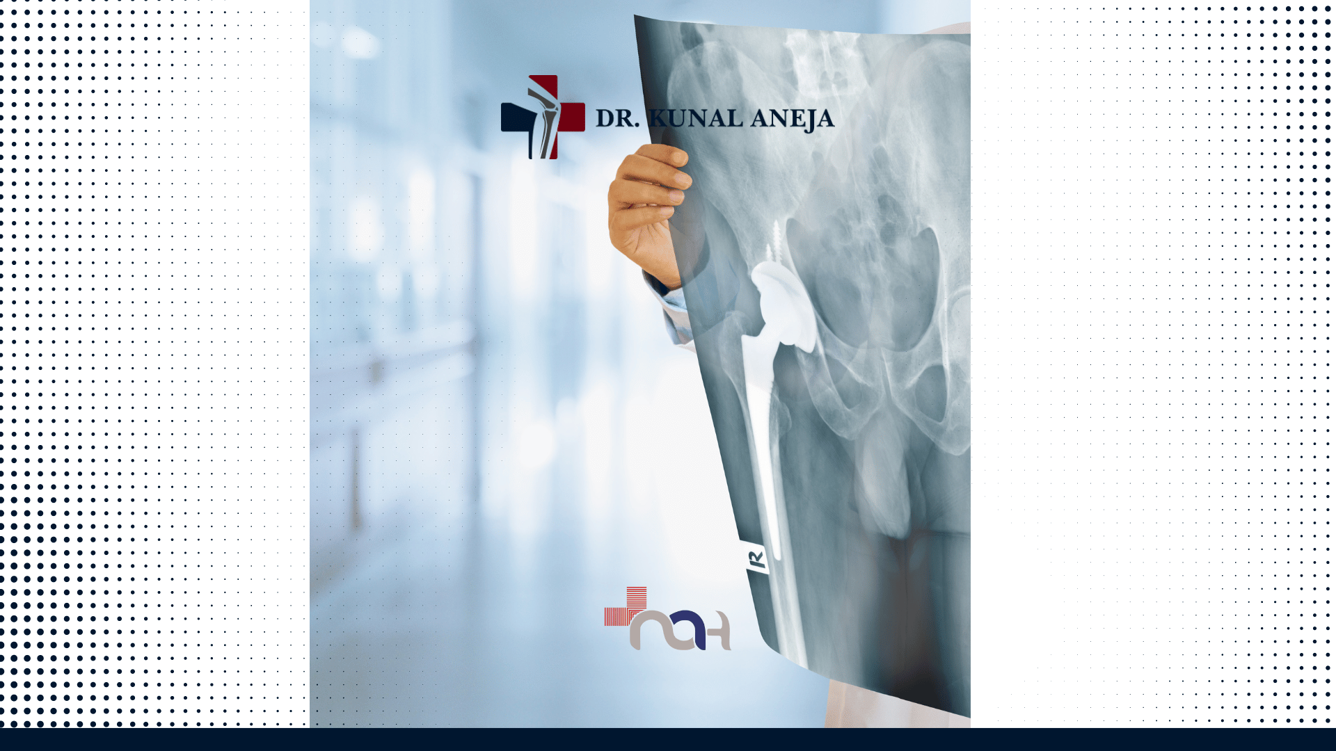 Dr. Kunal Aneja | Consultant Orthopaedic Surgeon In Delhi