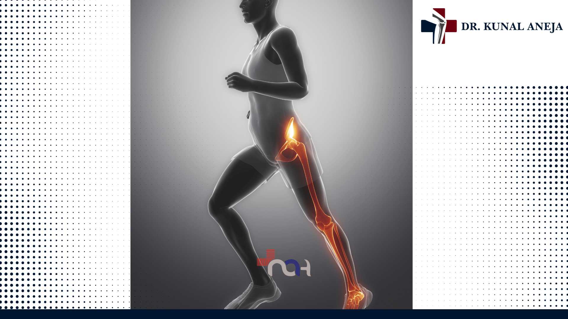 Dr. Kunal Aneja | Best Knee, Hip & Joint Replacement Surgeon in India