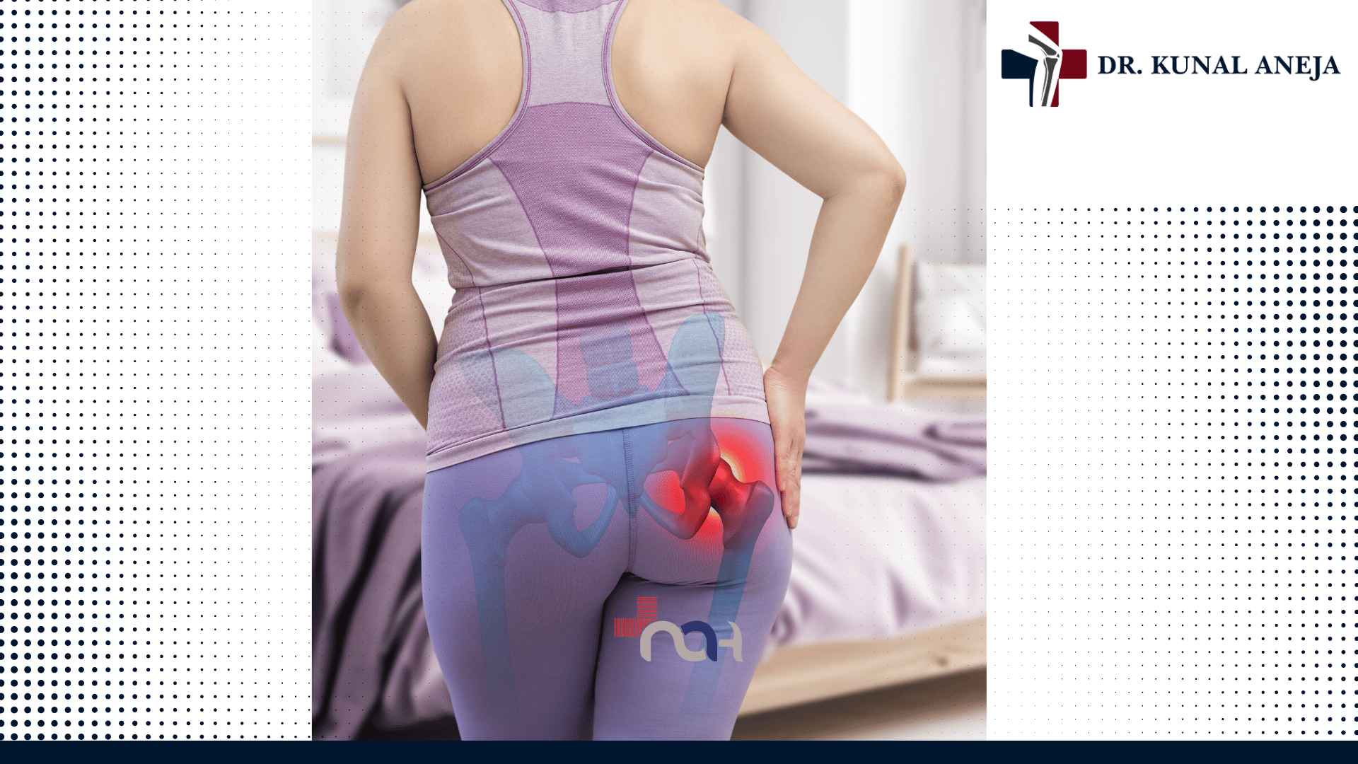 Advanced Total Hip Arthroplasty Solutions Delivered Across Delhi, India